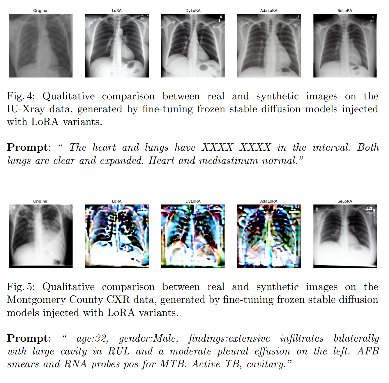 SeLoRA: Self-Expanding Low-Rank Adaptation of Latent Diffusion Model for Medical Image Synthesis